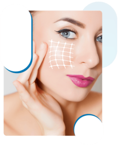 implant pommette : chirurgie pommette pour des pommettes saillantes